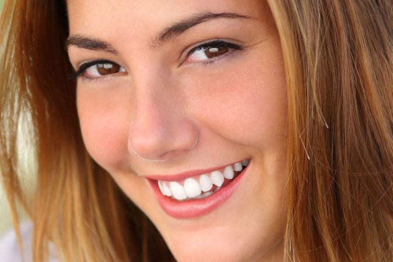 Composite Bonding - Dental Icon