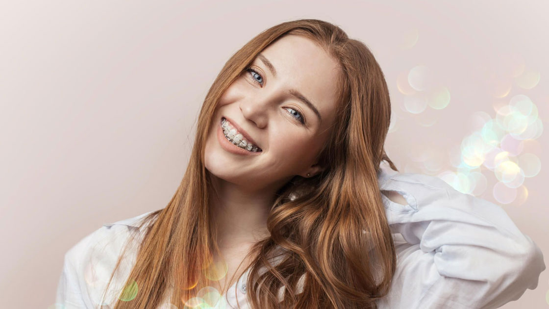 Fixed Braces - Dental Icon